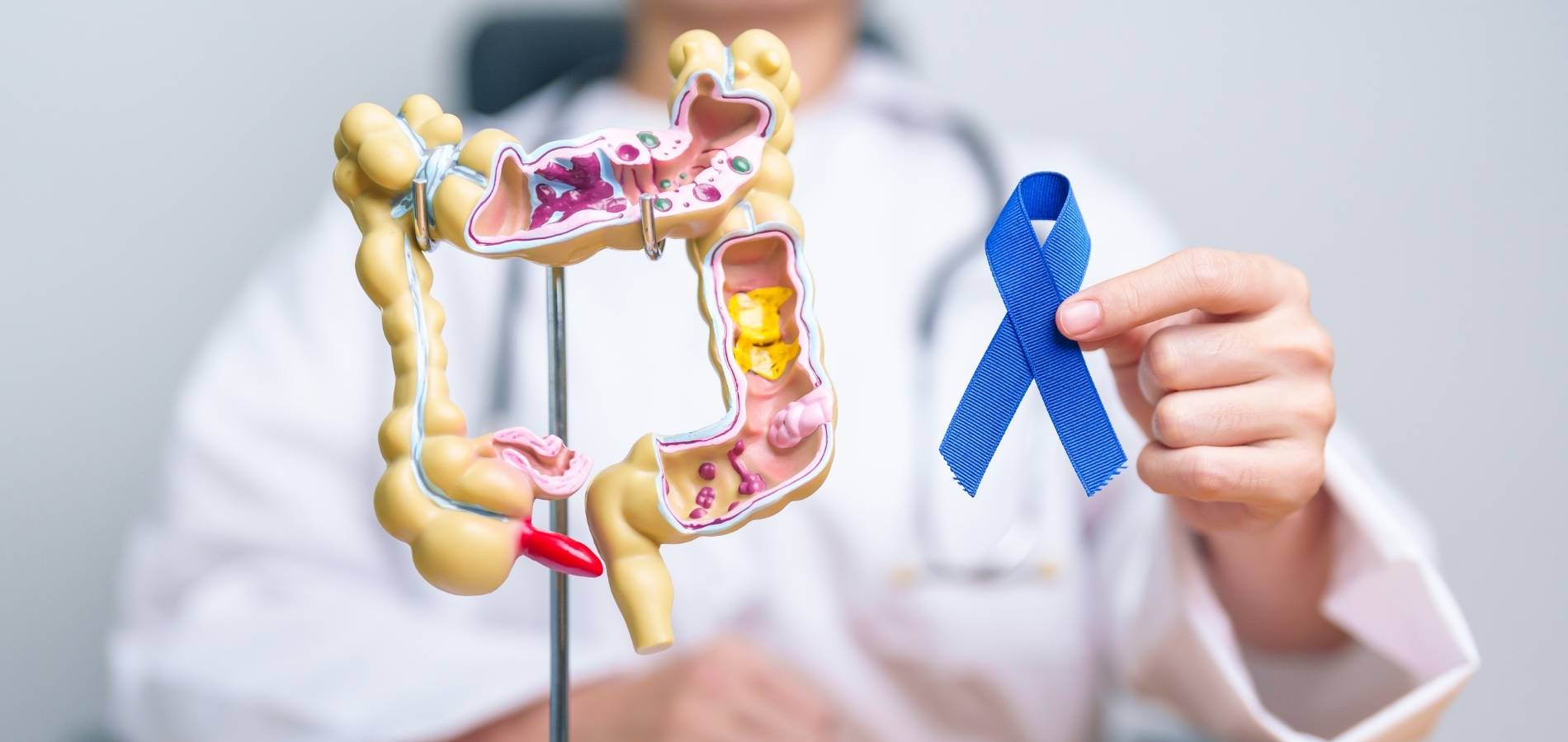 Colon Cancer Care | Alaska Oncology and Hematology